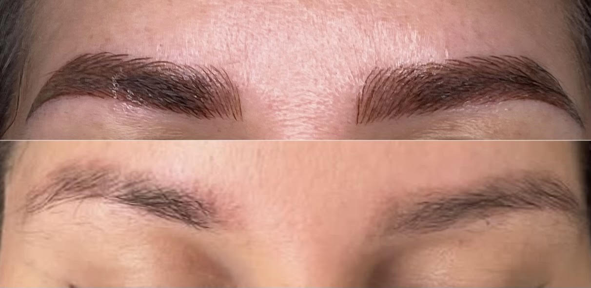 Emergency Microblading removal